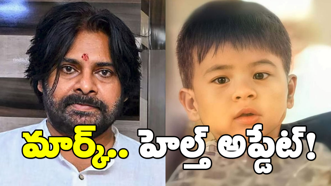 Breaking News: మార్క్ శంకర్‌కు ఇప్పుడెలా ఉందంటే..