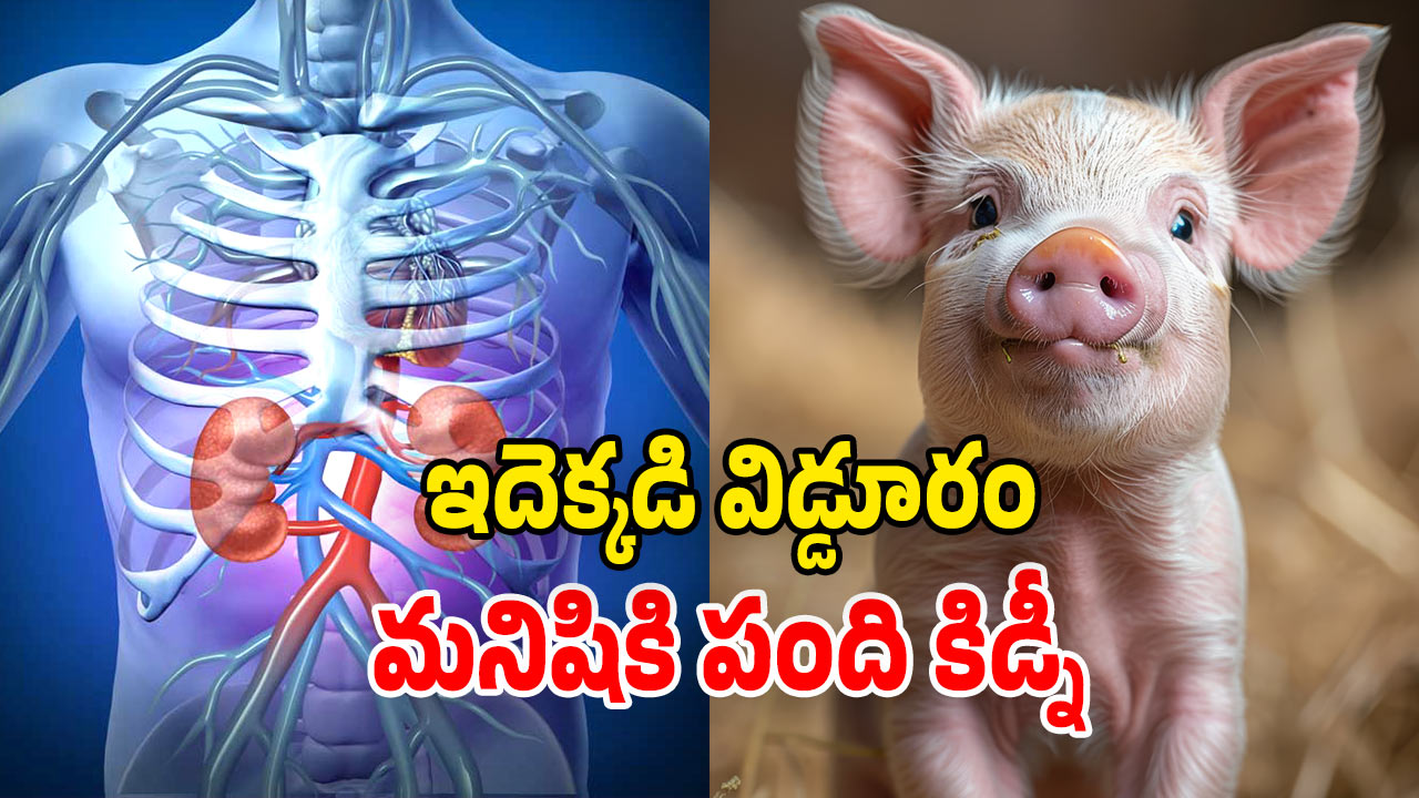 Pig Kidney Transplant: మనిషికి పంది కిడ్నీ అమర్చిన వైద్యులు